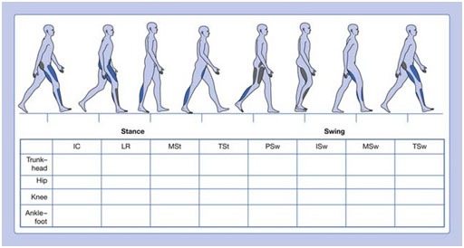 Gait Analysis with Dr. Roshan | Pain-Free Physiotherapy
