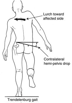 Gait Analysis with Dr. Roshan | Pain-Free Physiotherapy