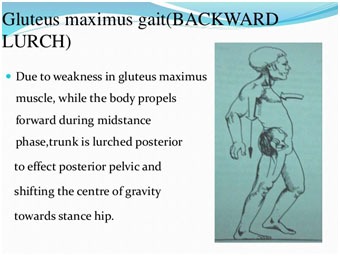 Gait Analysis with Dr. Roshan | Pain-Free Physiotherapy